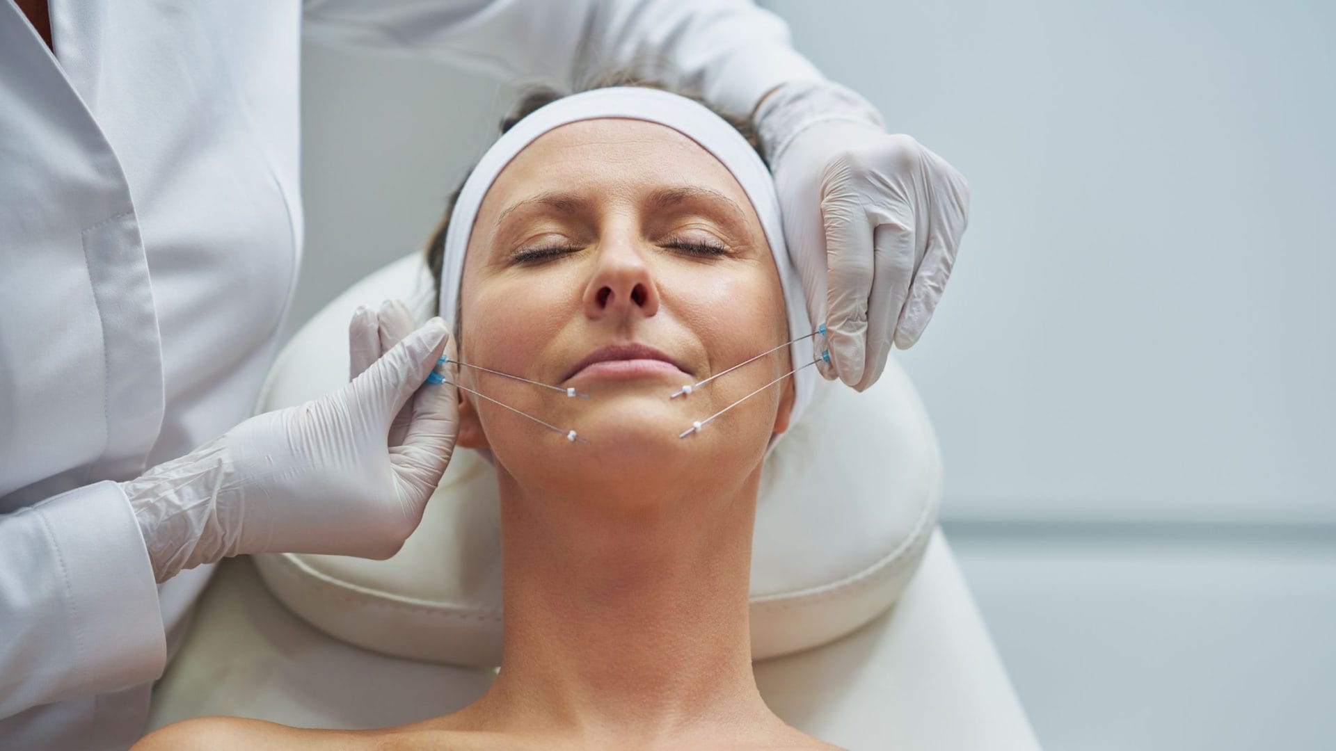 Best Non-Surgical Thread Lift Treatment in Udaipur - Arthskinfit